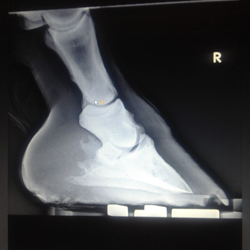 MagRayCloxx - Podoblock USA